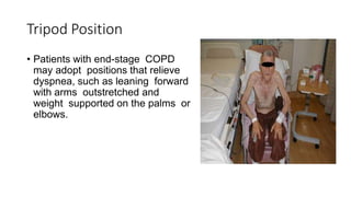 Tripod Position Copd