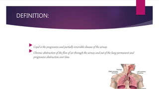 Copd. pptx | PPTX