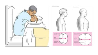 COPD(Chronic Obstructive Pulmonary Disease) a7med-mo7amed | PPTX | Lung ...