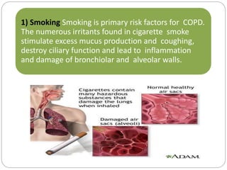 Copd | PPTX