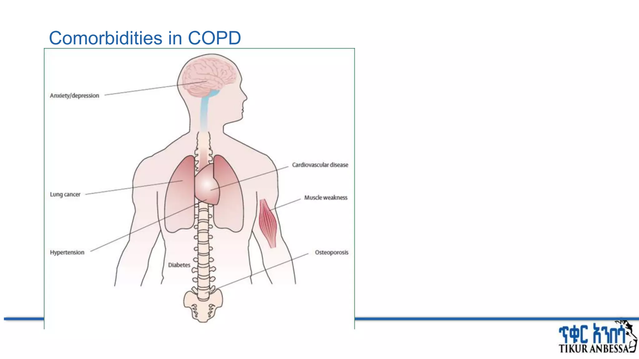 COPD.pptx