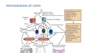 COPD.pptx