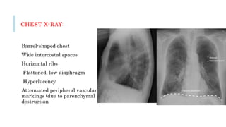 COPD.pptx