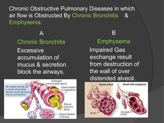 Presentation COPD.pptx