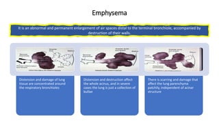 COPD.pptx