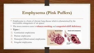 COPD.pptx