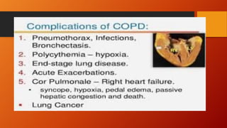COPD.pdf