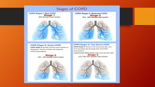 COPD.pdf
