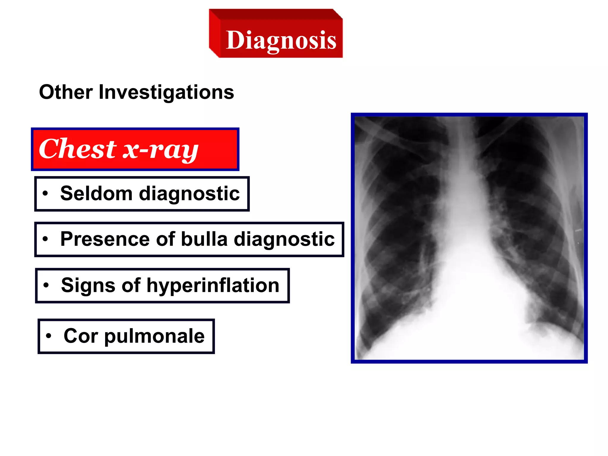 COPD.pptx