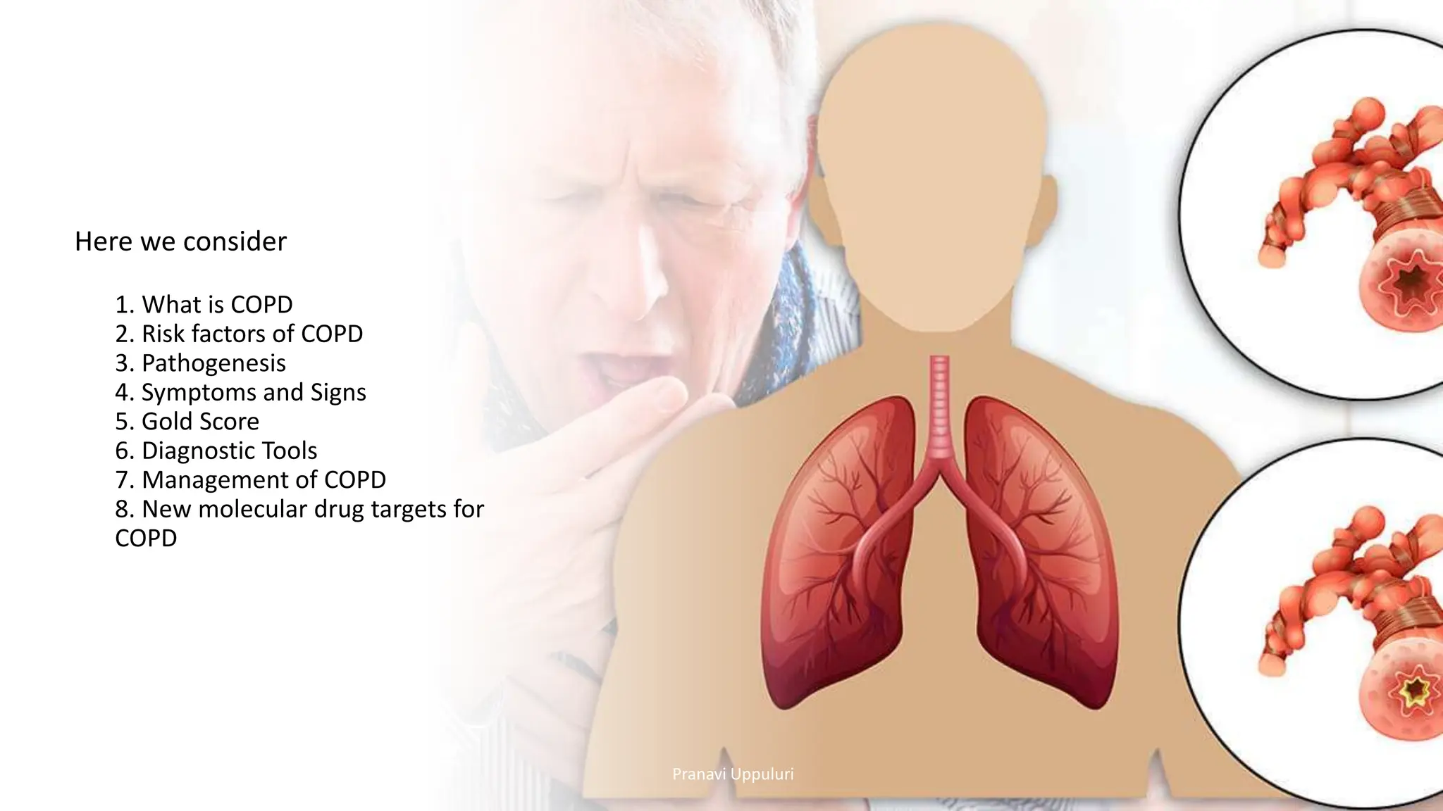 COPD.pptx