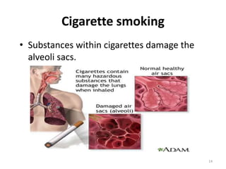 CHRONIC OBSTRUCTIVE PULMONARY DISEASE(COPD).pptx