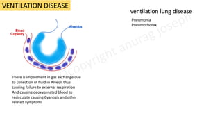 Chronic Obstructive Pulmonary Disease, Nursing | PDF
