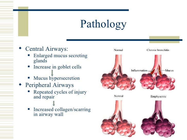 Copd And The Gold Guidelines 02 21 2005[2]