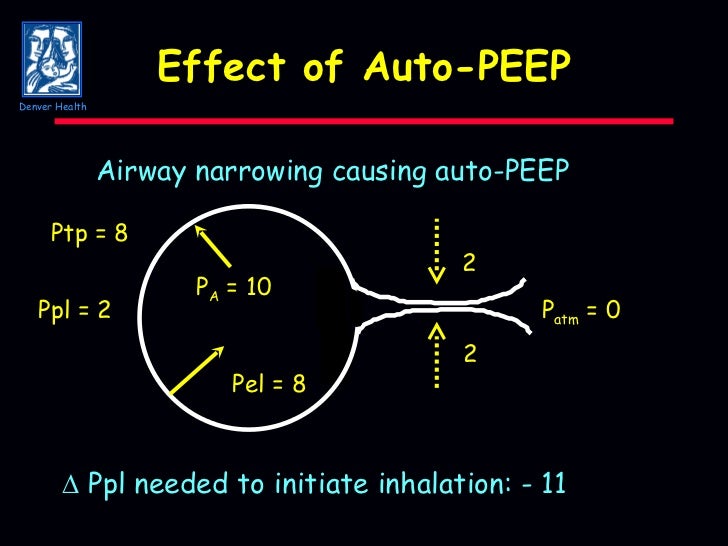 Mechanical Ventilation of Patients with COPD and Asthma