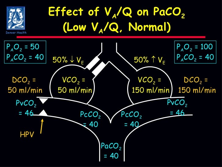 Mechanical Ventilation Of Patients With COPD And Asthma mechanical-ventilation-of-patients-with-copd-and-asthma