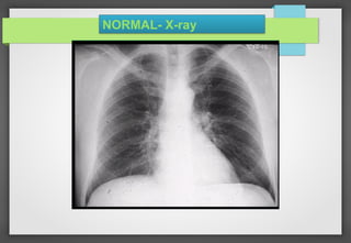COPD-copd copd copd copd copd copd c ENG.pptx