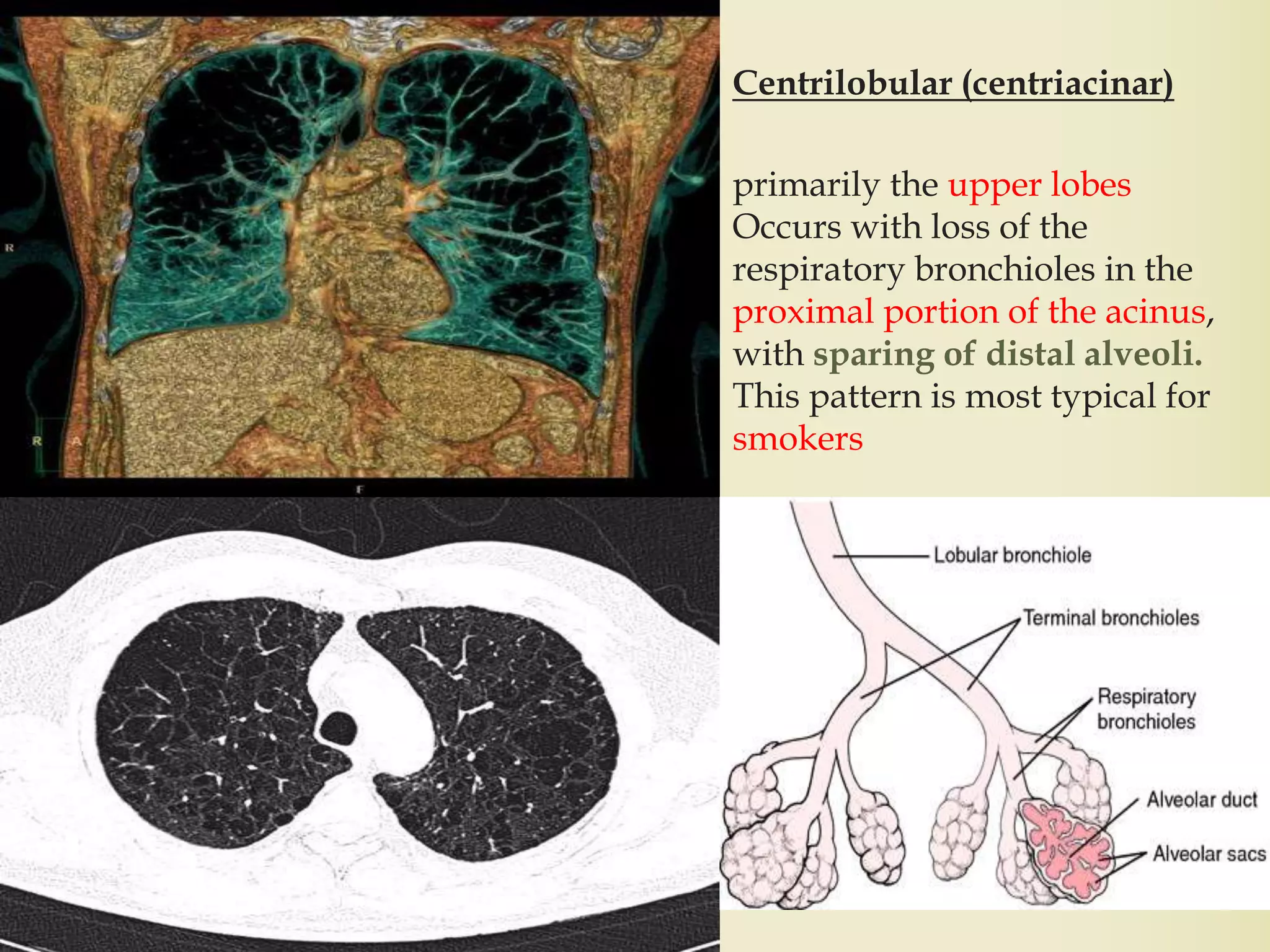 COPD overview and update | PPTX