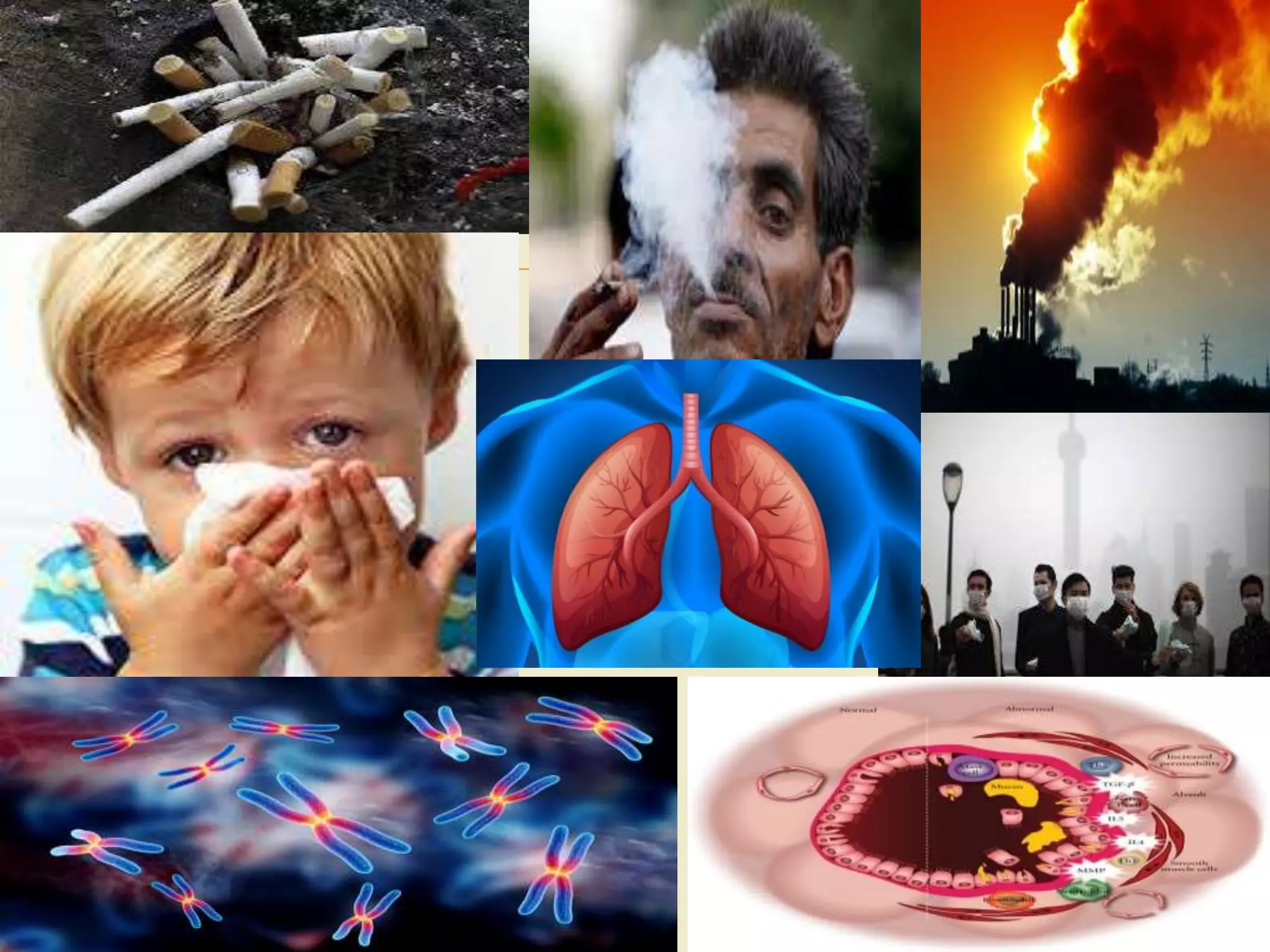 COPD overview and update | PPTX