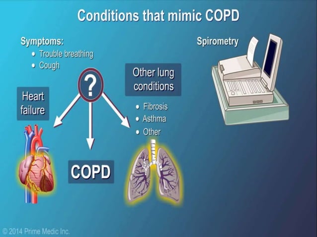 CODP ( Chronic Obstructive Pulmonary Disease ) | PPTX