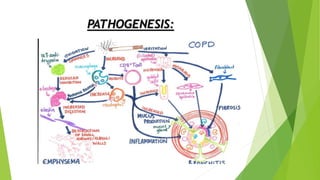 Copd and anaesthetic considerations | PPTX