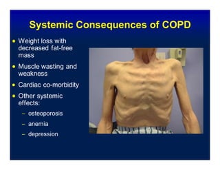 Copd and asthma | DOCX