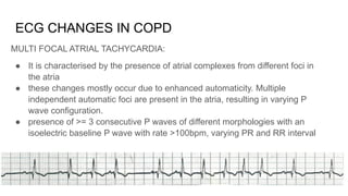 COPD and GOLD guidelines and management.pptx