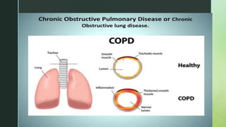 Chronic obstructive pulmonary disease and pneumonia.pptx