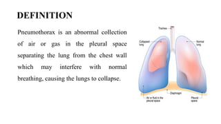 COPD | PPTX
