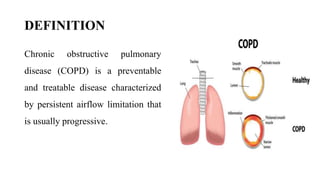 COPD | PPTX