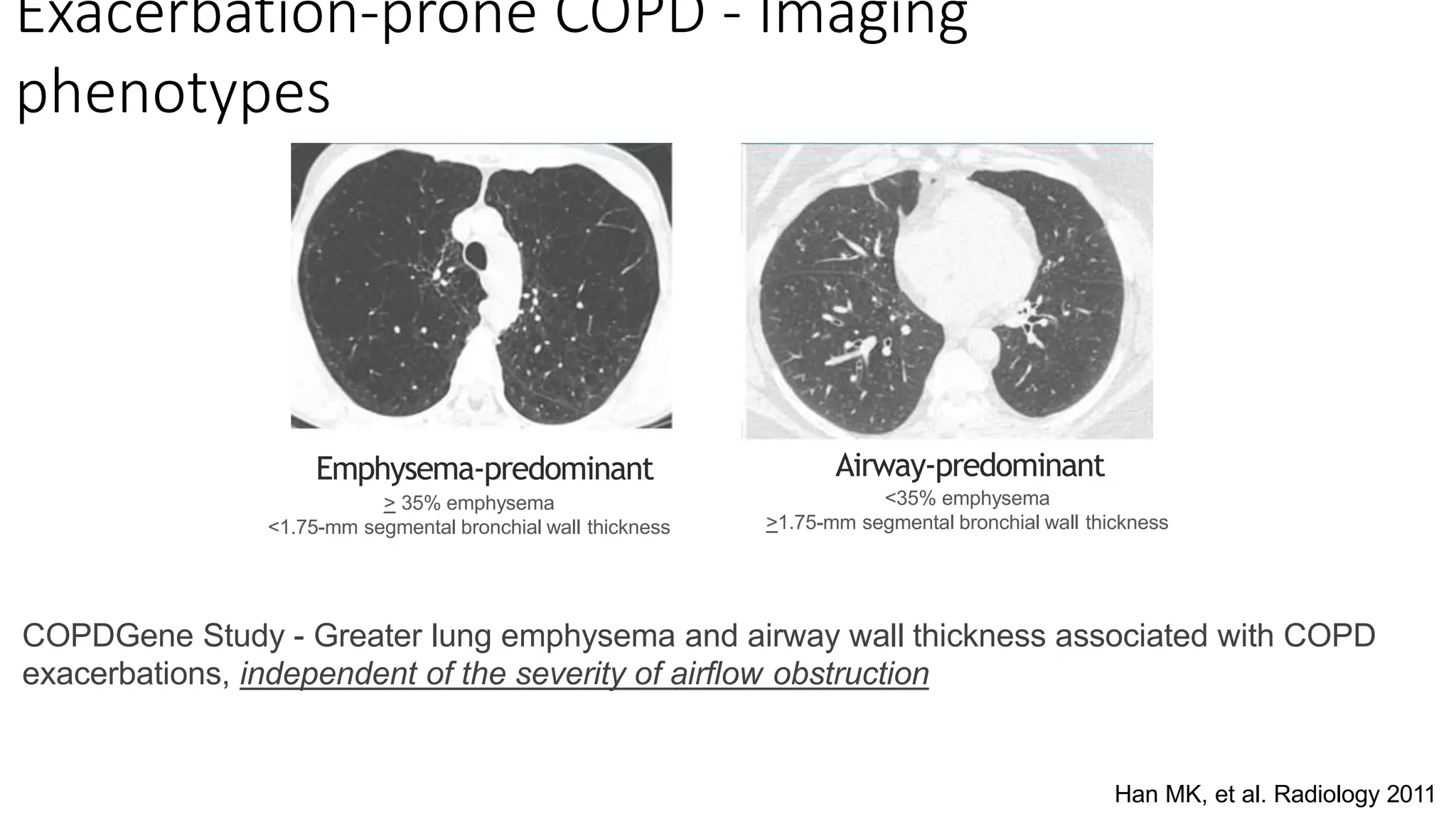 COPD CHEST.pptx