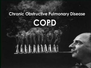 COPD definition, phenotypes, epidemiology | PPTX