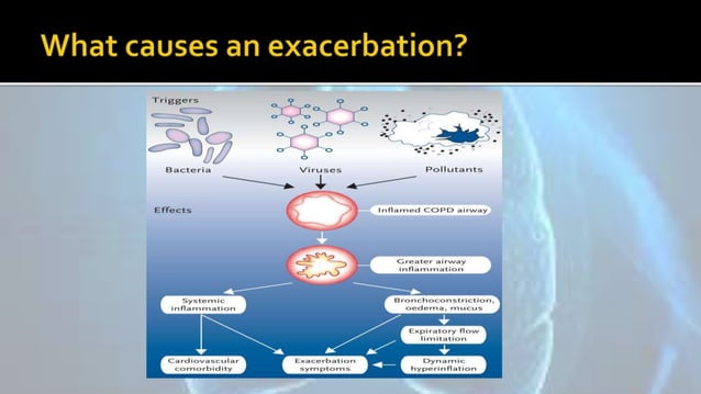 COPD: Management of Acute Exacerbation | PPTX