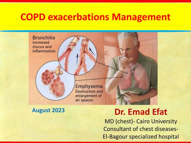 COPD exacerbations Management.pdf