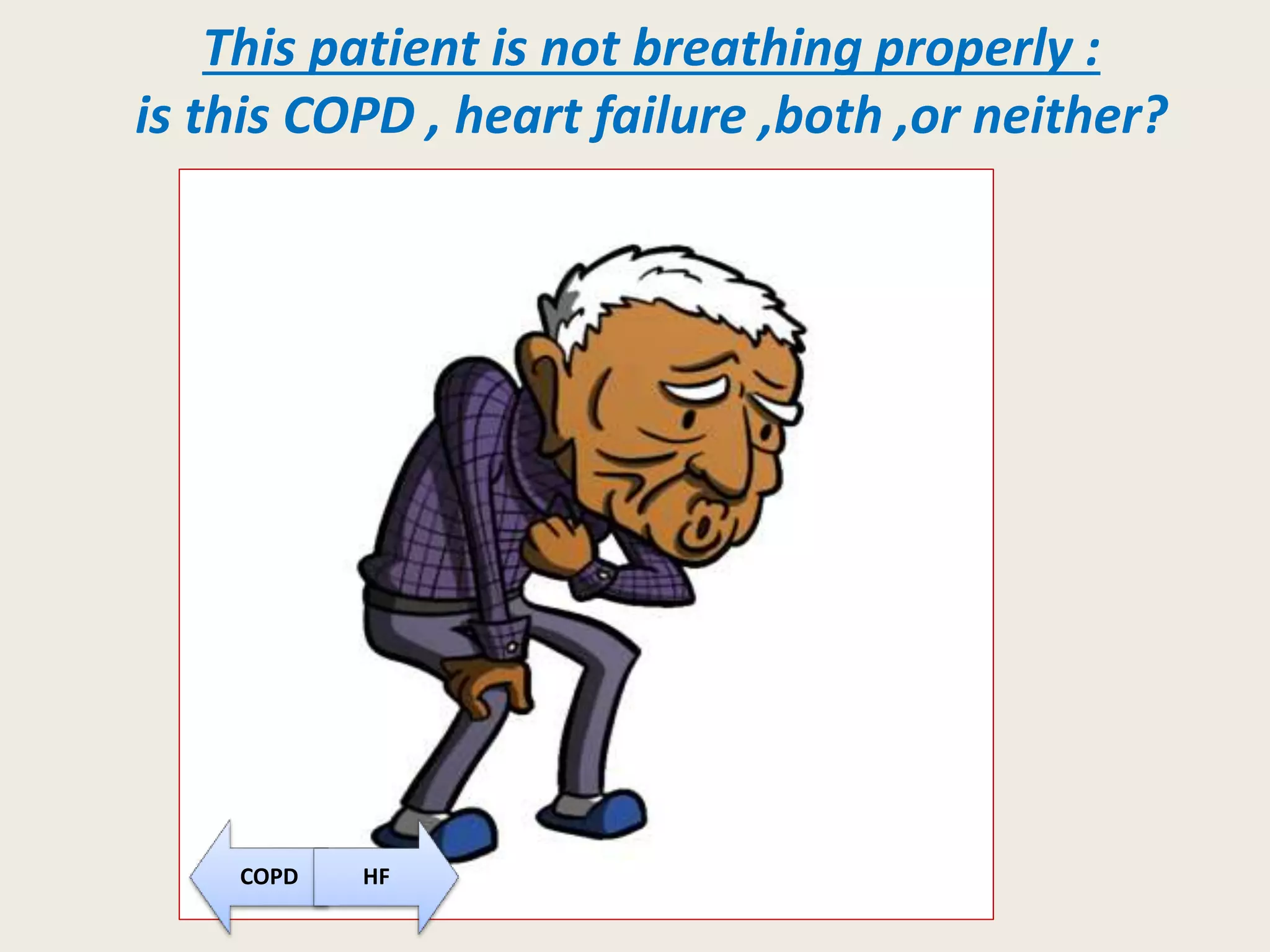 Chronic Obstructive Pulmonary Disease and Heart Failure The challenges ...