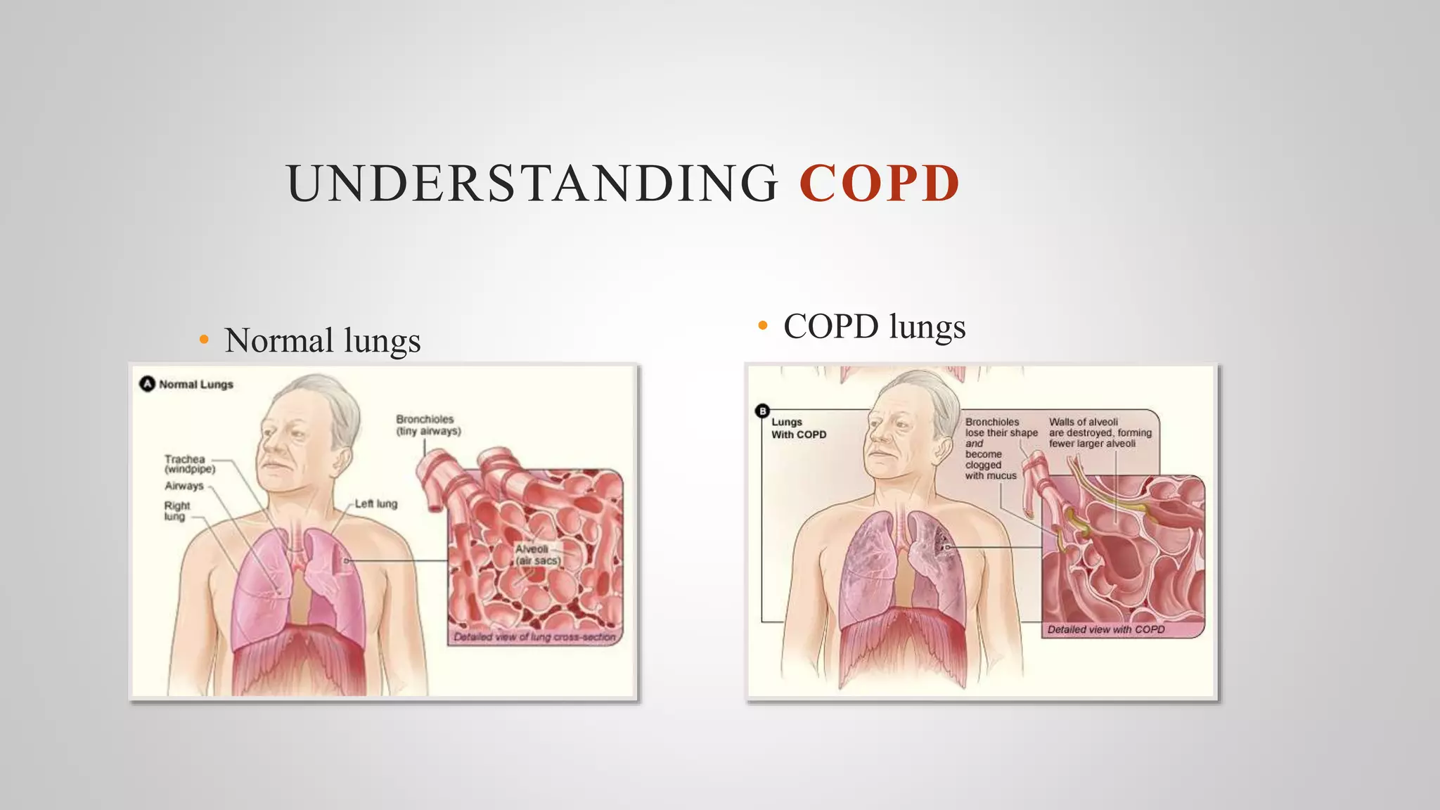 COPD INTRODUCTION.pptx