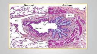COPD INTRODUCTION.pptx
