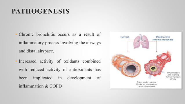 COPD INTRODUCTION.pptx