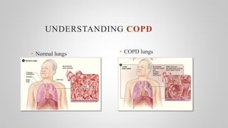 COPD INTRODUCTION.pptx