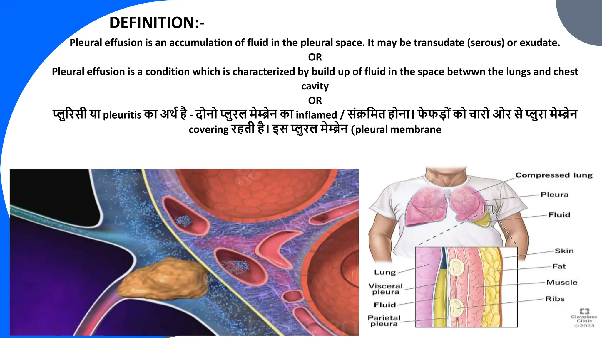 CHRONIC OBSTRUCTIVE PULMONARY DISEASE (COPD ) Jitendra bhargav ...