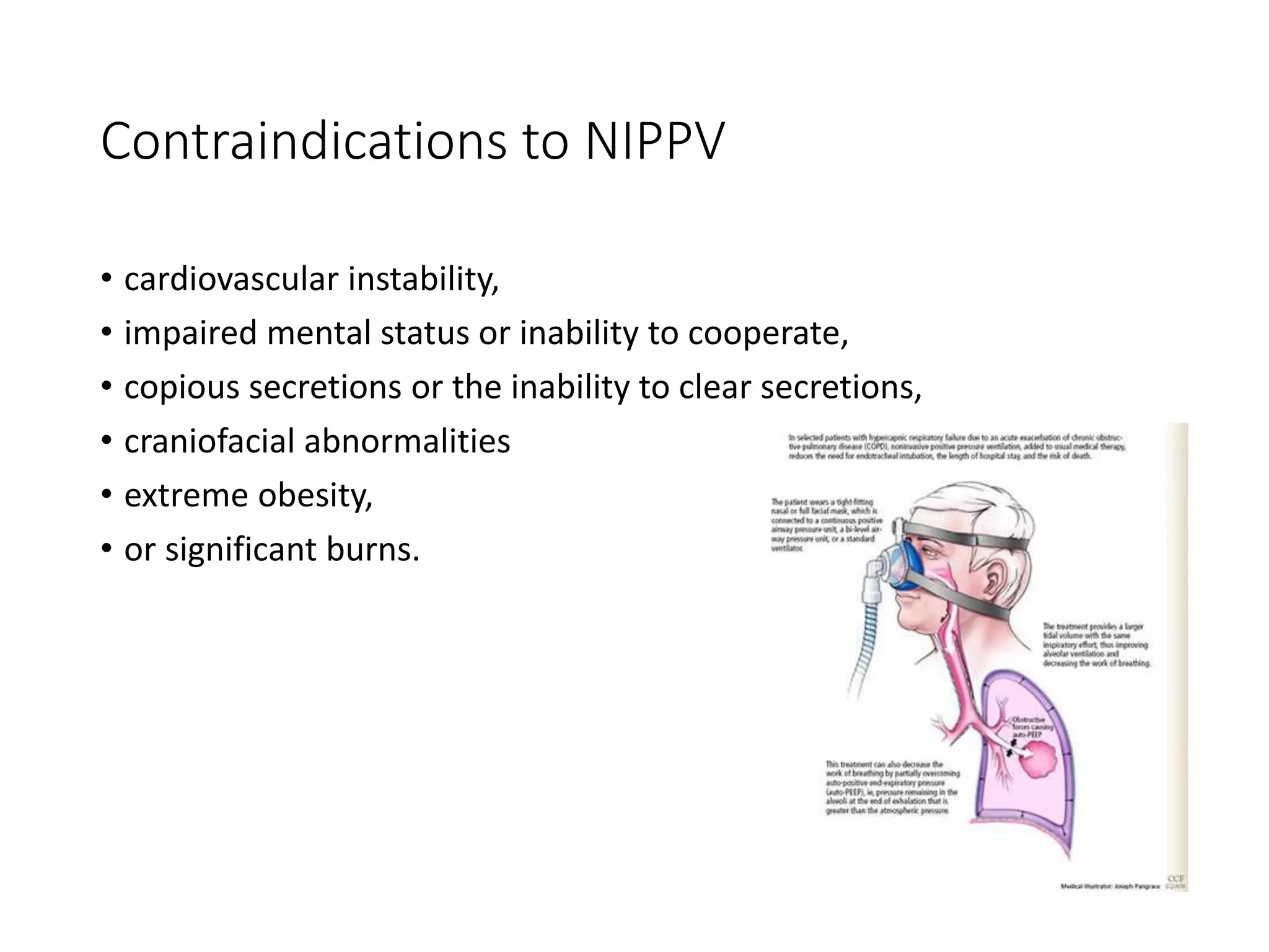 Copd management | PPTX
