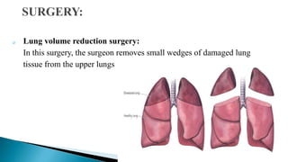 COPD | PPTX