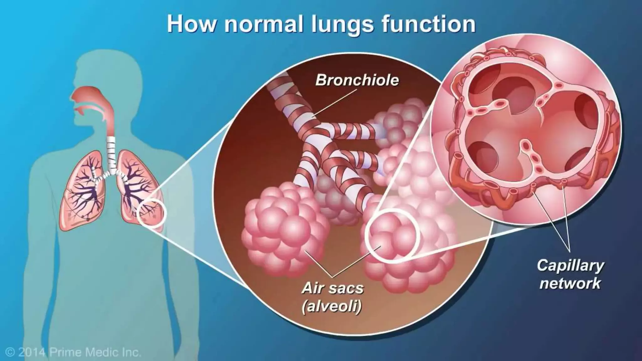 COPD(chronic obstructive pulmonary disease) ppt slideshare | PPTX
