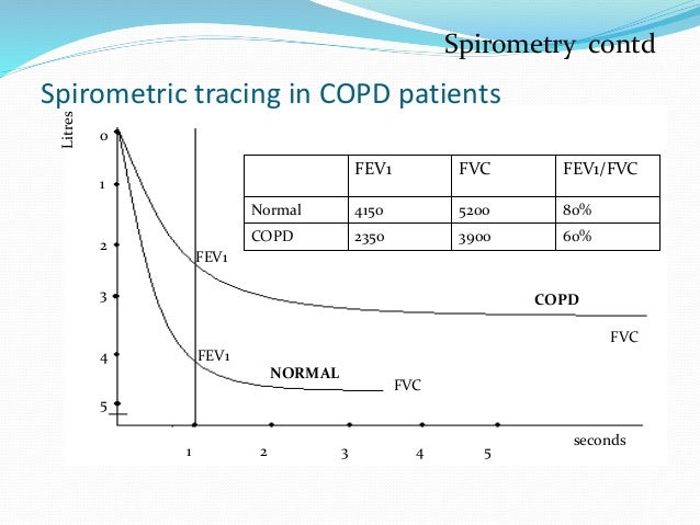 Copd introduction and pft