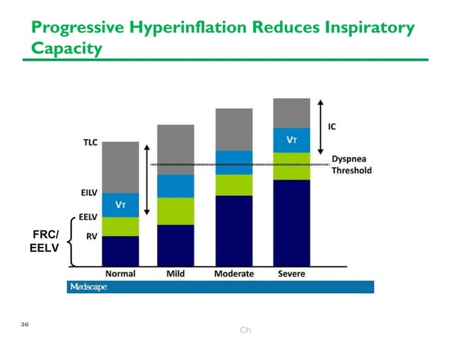 ABC of COPD 2017 | PPT