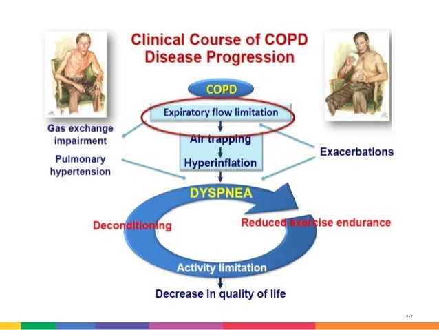 ABC of COPD 2017