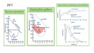 COPD vs Asthma. | PPTX