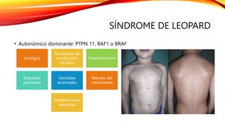 ESTENOSIS VALVULAR PULMONAR 2.pptx