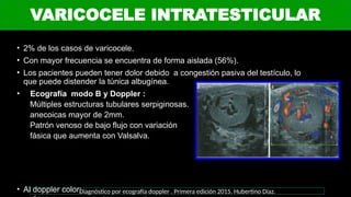 DOPPLER TESTICULAR :EVALUACION DE VARICOCELE | PPTX