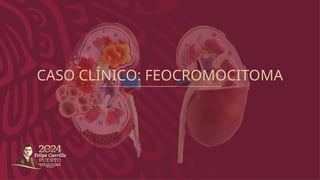 ¿Que es el feocromocitoma? Caso clinico! | PPTX