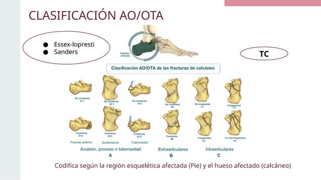 Fractura de retropié traumatología y ortopedia.pptx